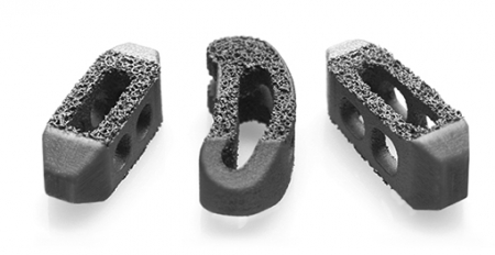 Titanium Lumbar Cage for Spine Fusion - TirboLOX-L TLIF Cage