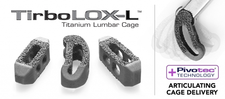 TirboLOX-L Titanium Lumbar Cages Receive Clearance - 3D Printed