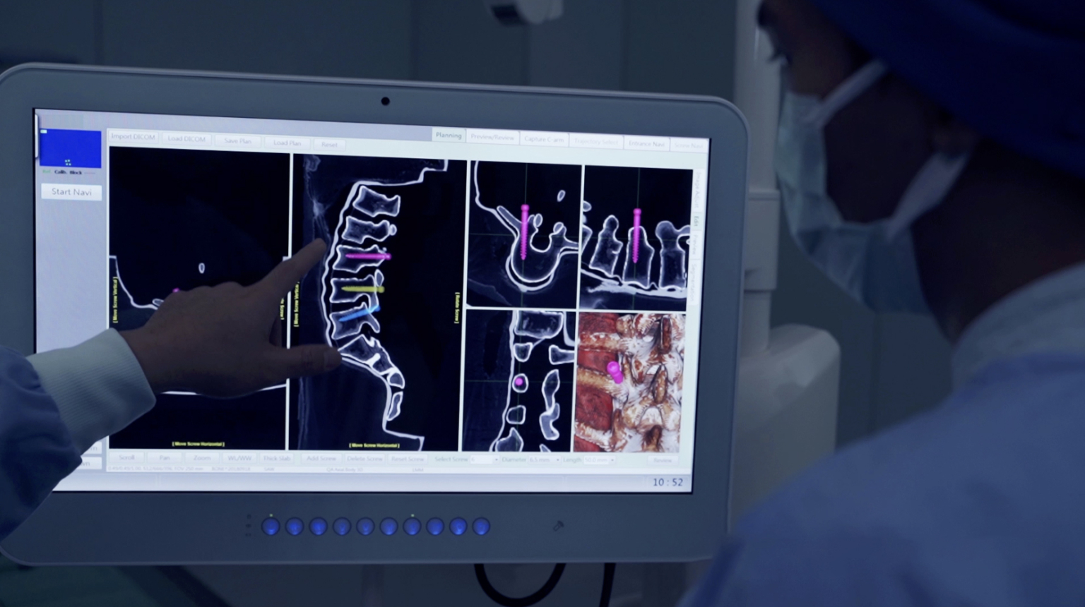 Spine Navigation and Robotics - Real-Time 3D Navigation