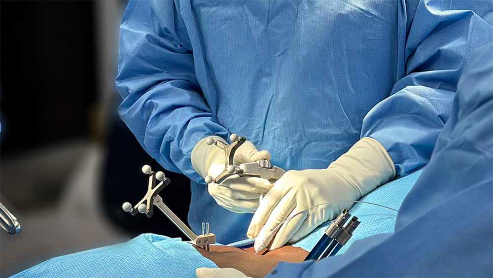 Interview on ASC-READY WatchTower Spine Navigation System