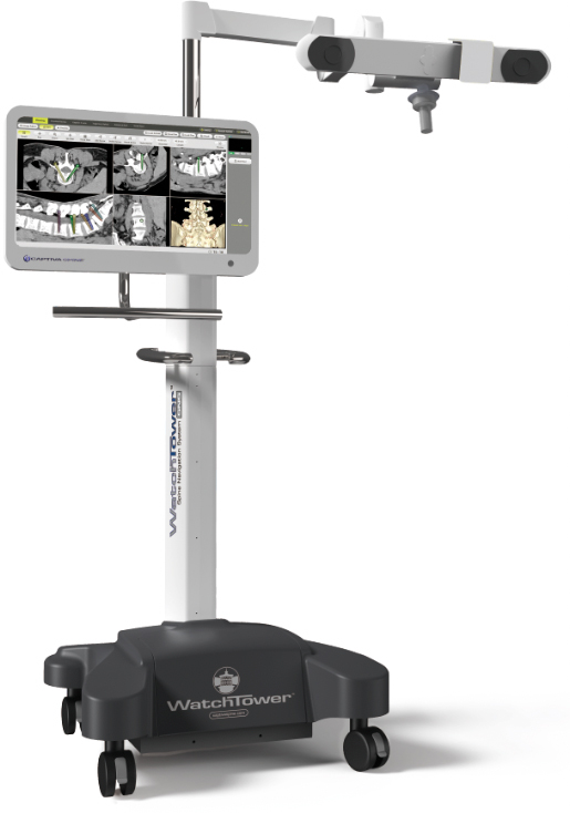 Suggested: WatchTower SNS - Tower Overview - captivaspine.com